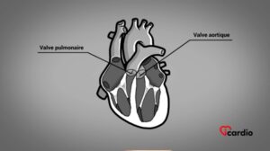 Les valves tricuspides – Icardio