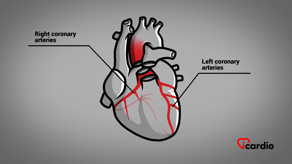 Spontaneous Coronary Artery Dissection (SCAD) – Icardio