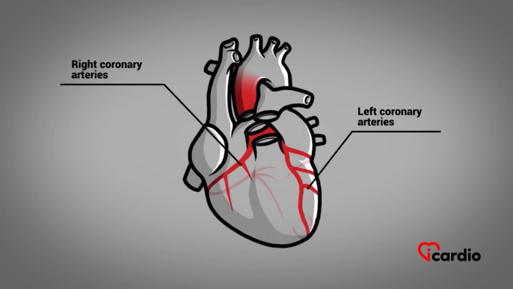 The Coronary Arteries – Icardio