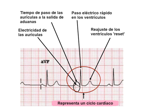 Electrocardiograma (ECG) – Icardio