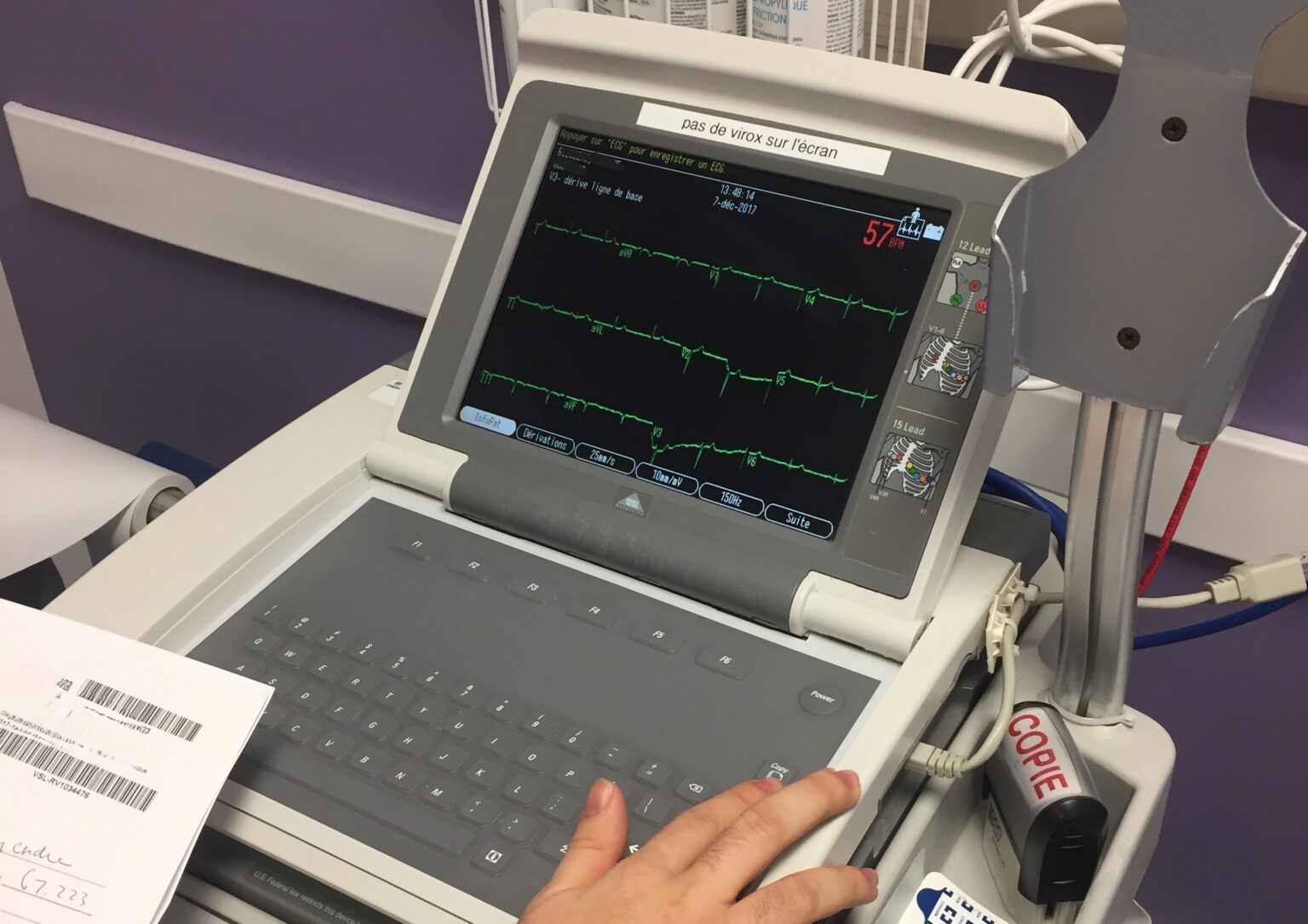 Electrocardiogram (ECG or EKG) – Icardio