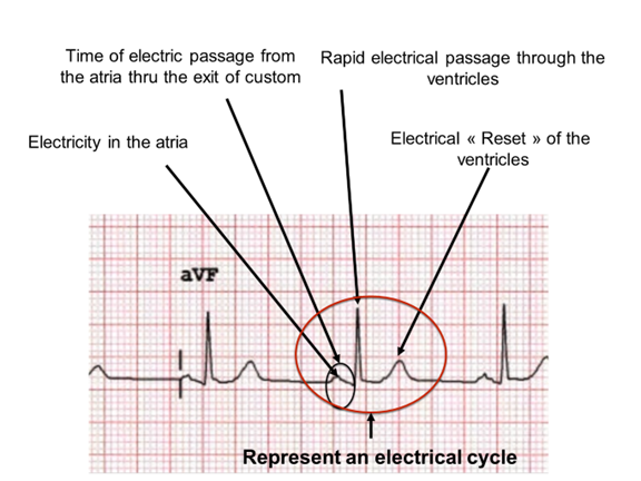 Electrocardiogram (ECG or EKG) – Icardio