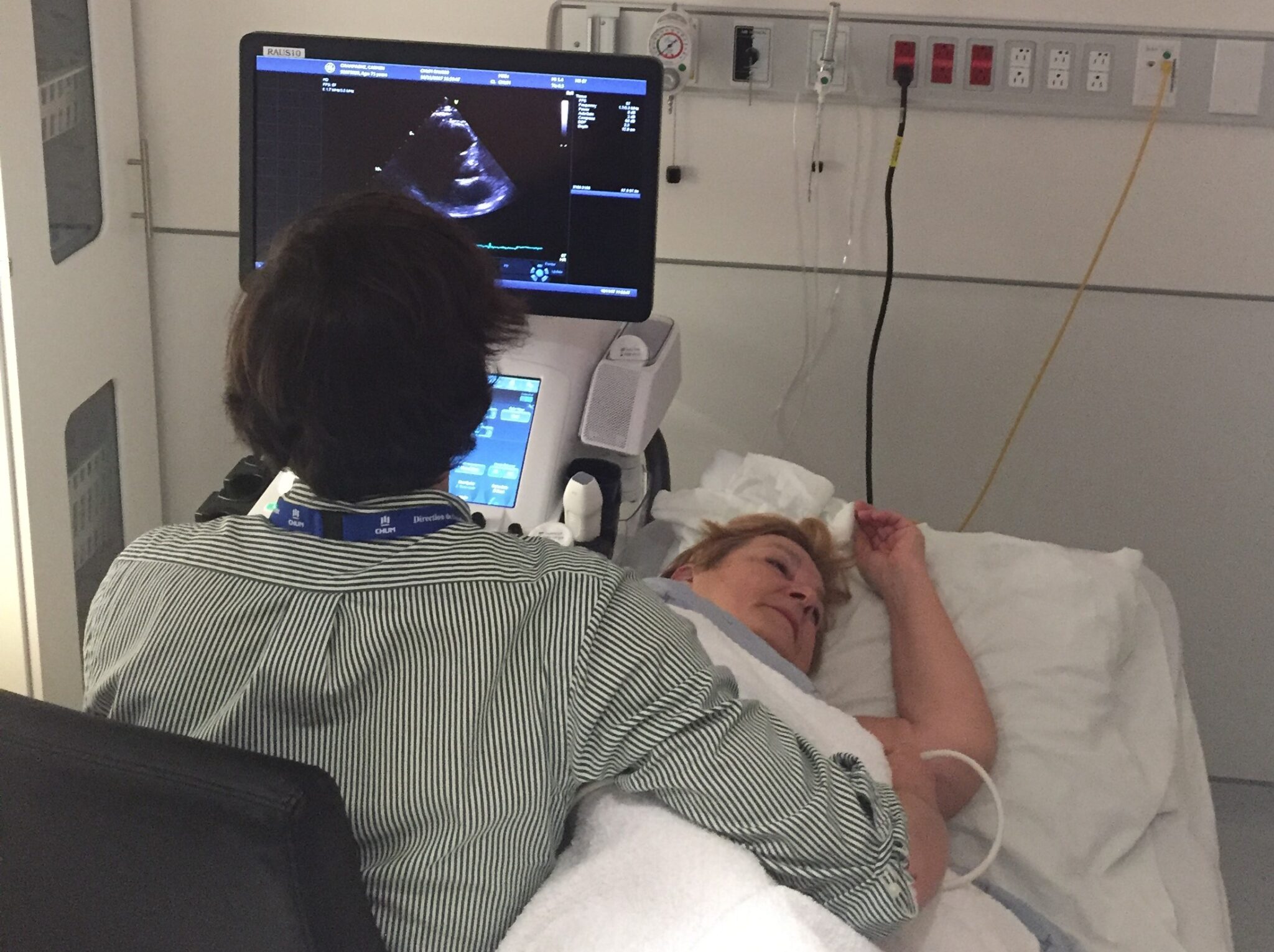 Treadmill Stress Echocardiography – Icardio