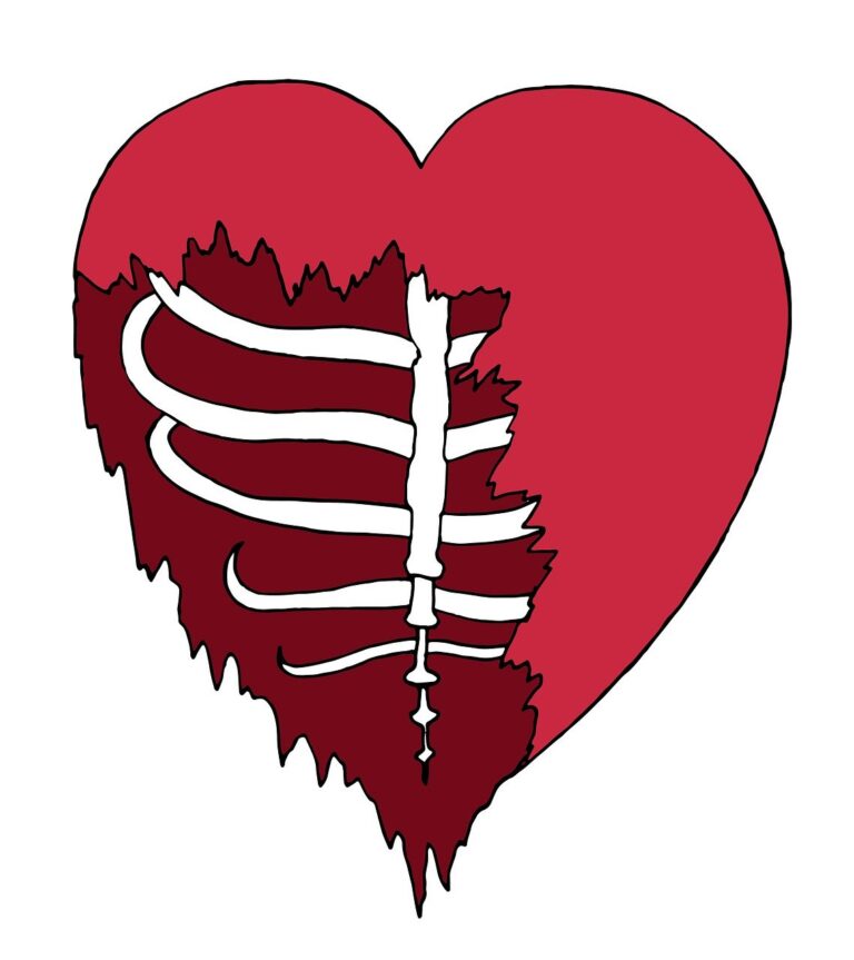 The Fibrous Skeleton of the Heart – Icardio