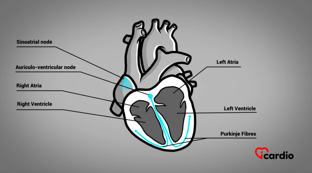 Disorders of Heart Rhythm – Icardio